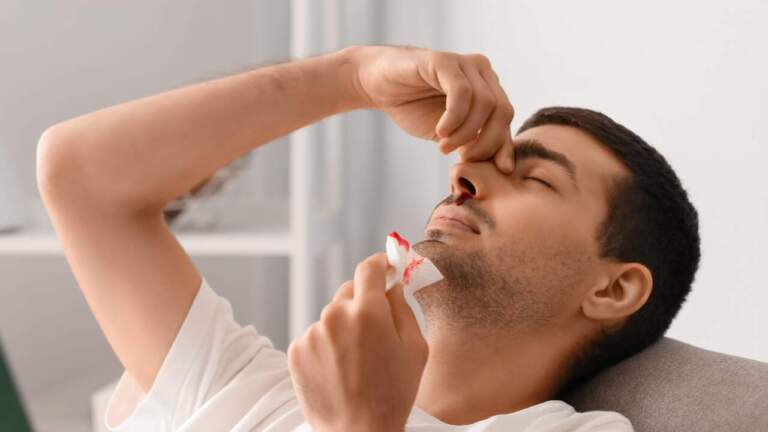 Was tun bei Nasenbluten? Ursachen und Behandlung | FLEXEO
